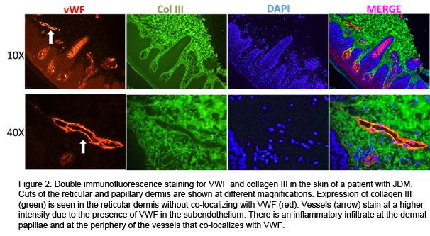 Von Willebrand Factor is Localized in the Extravascular Tissue of ...