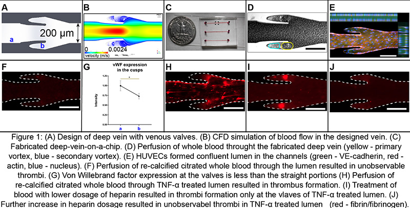 DVT-on-Chip: In-vitro Model of Deep Vein Thrombosis Including.... ISTH ...