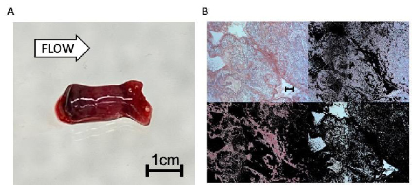 White Clot is More Permeable and Stronger than the Red Clot. ISTH ...