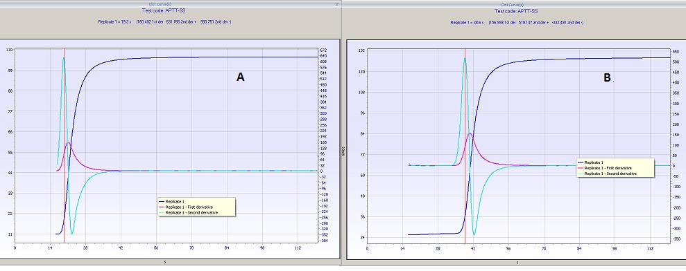 APTT Clot Waveform Analysis: A Tool in Prediction of Pre-Analytical ...